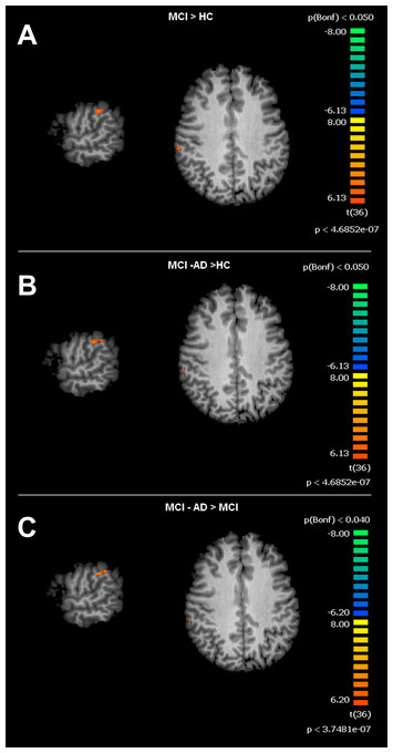 Characterization of resting state activity in MCI individuals [PeerJ]