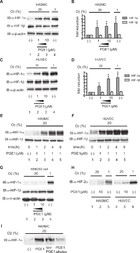 Differential roles of prostaglandin E-type receptors in activation of ...