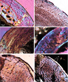 Bone microstructure and the evolution of growth patterns in Permo ...