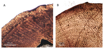 Bone microstructure and the evolution of growth patterns in Permo ...