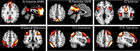 Modulatory interactions between the default mode network and task ...