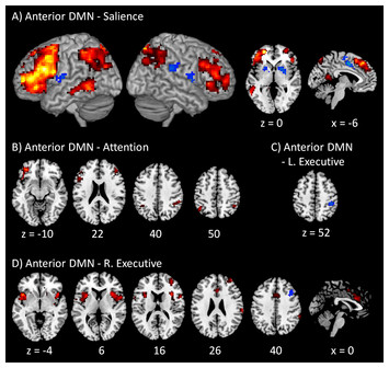 Modulatory interactions between the default mode network and task ...