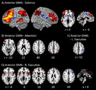Modulatory interactions between the default mode network and task ...