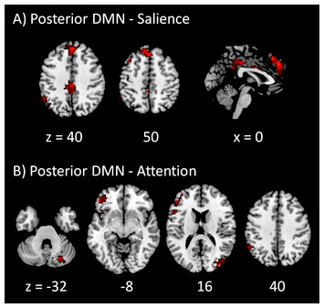 Modulatory interactions between the default mode network and task ...