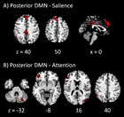 Modulatory interactions between the default mode network and task ...