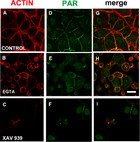 VERO cells harbor a poly-ADP-ribose belt partnering their epithelial ...