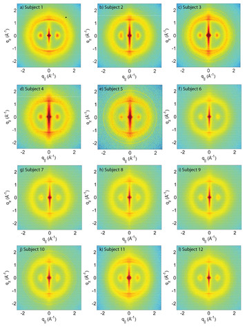 The structure of people’s hair [PeerJ]