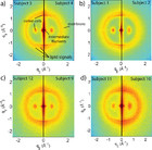 The structure of people’s hair [PeerJ]