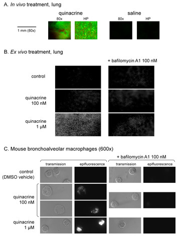 Autophagic flux inhibition and lysosomogenesis ensuing cellular capture ...